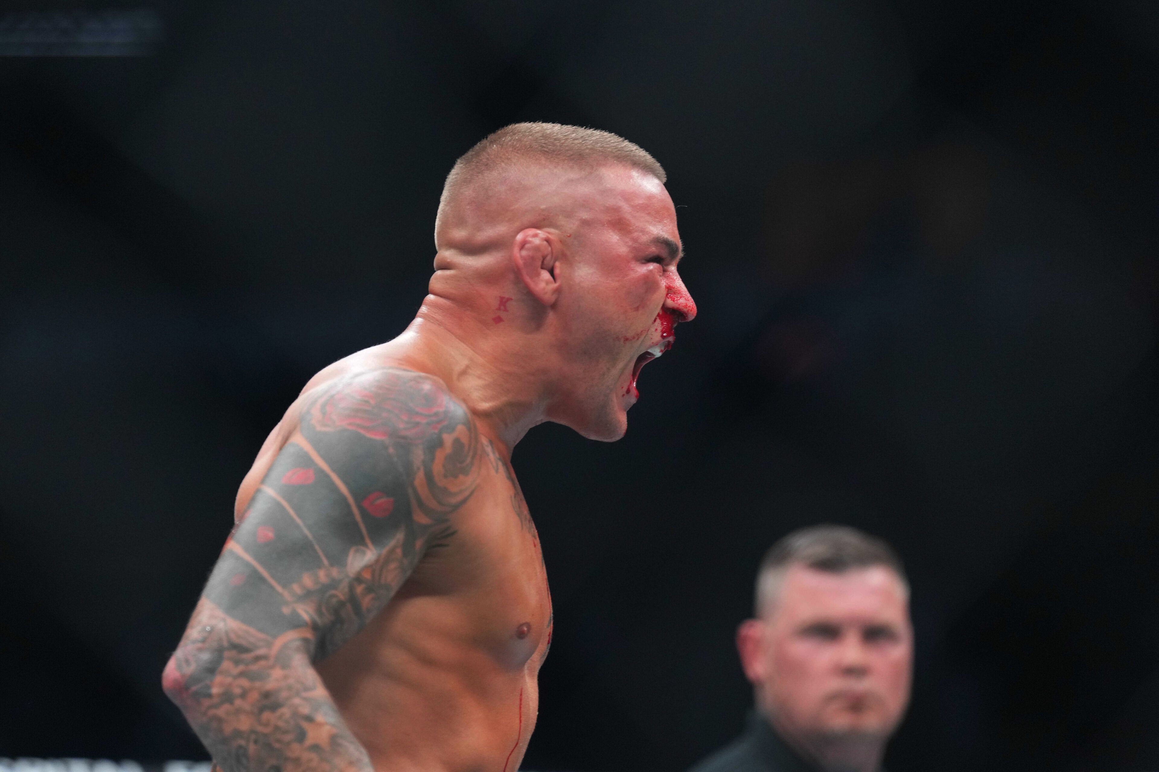 WATCH: Dustin Poirier’s Mouthguard for His ‘Last Dance’ Is a Thing of ...