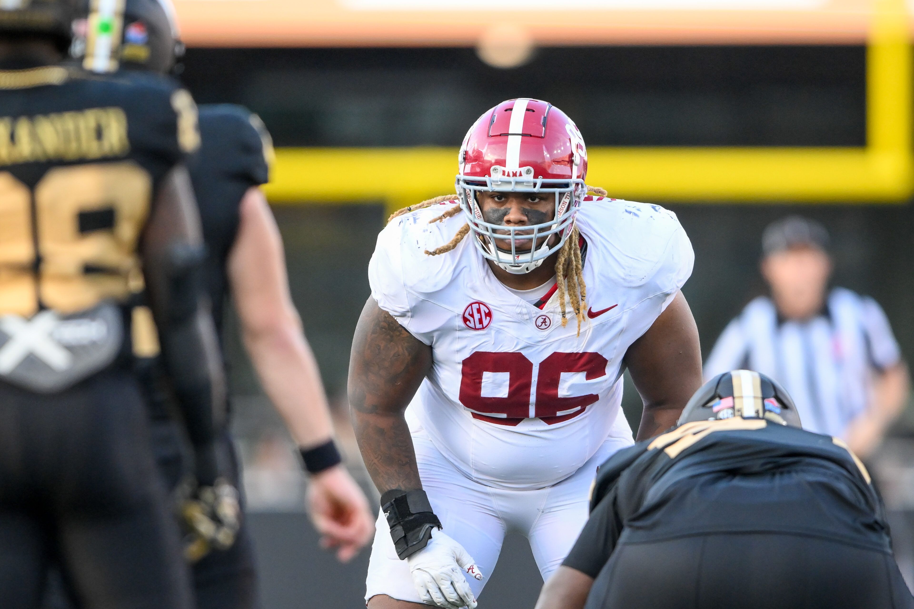 What is 'Tightrope Surgery' That Alabama's Tim Keenan Will Undergo and ...