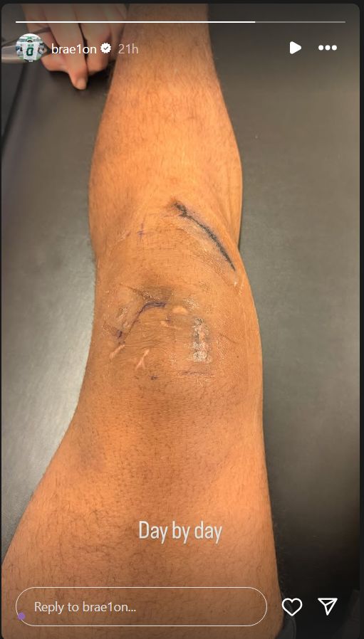 Jets RB Braelon Allen Announces Major Injury Update